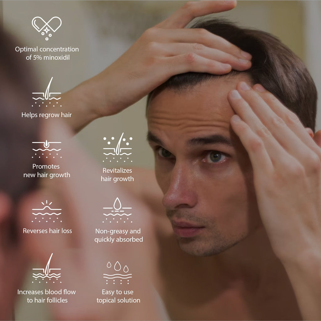 Buy Avogain 5% Minoxidil Topical Solution for Hair Growth 50 mL Online